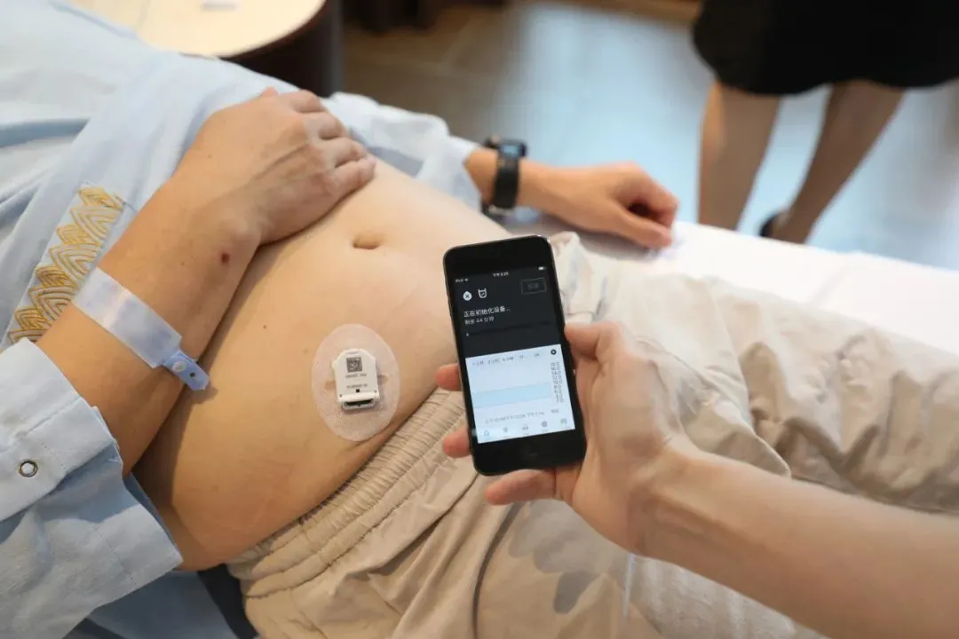 2021 EASD研究速递，全新CGMs多部位准确方便控糖医药新闻-ByDrug-一站式医药资源共享中心-医药魔方