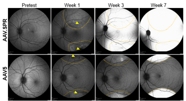 Atsena Therapeutics公布新型AAV载体治疗XLRS的临床前积极数据医药新闻-ByDrug-一站式医药资源共享中心-医药魔方